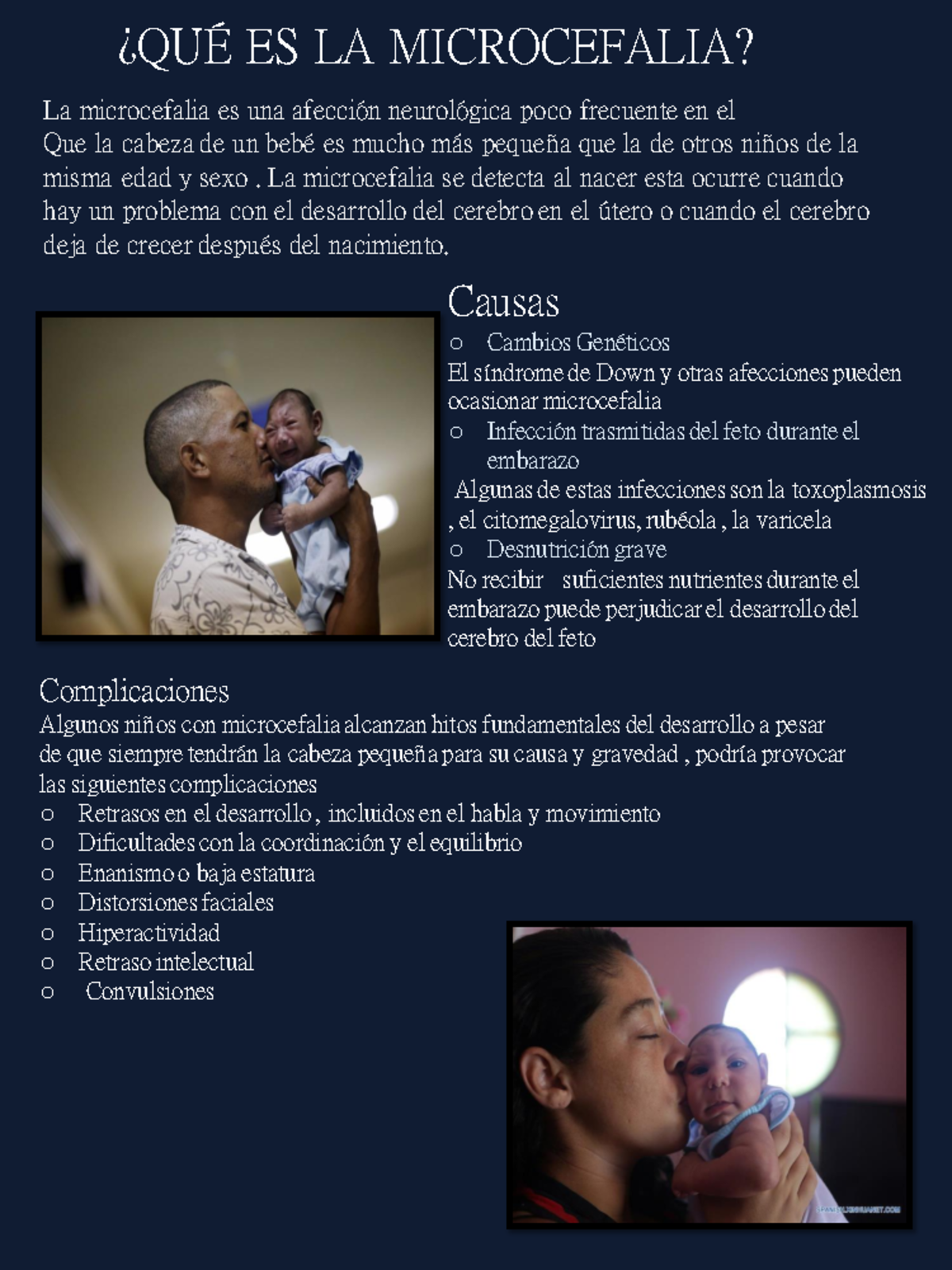 Microcefalia - La microcefalia se detecta al nacer esta ocurre cuando hay un problema con el ...