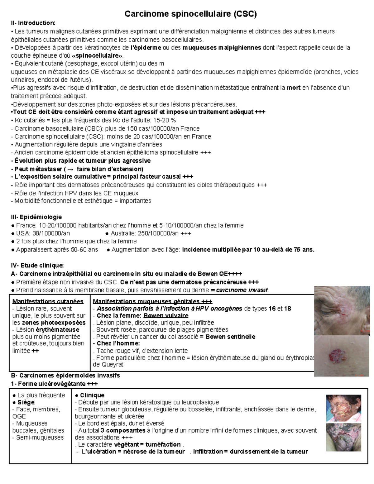Carcinome spinocellulaire - Développées à partir des kératinocytes de l ...