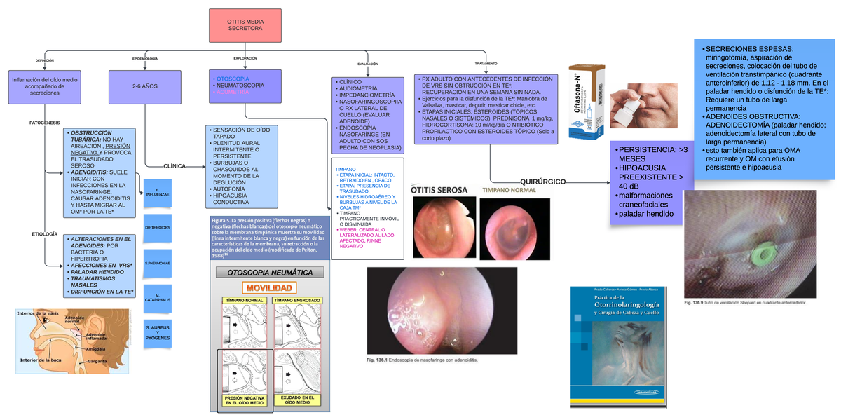 OTITIS MEDIA SEROSA - OTITIS MEDIA SECRETORA Inflamación del oído medio ...