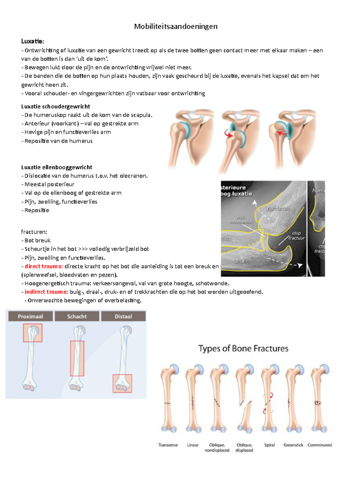 Mobiliteitsaandoeningen - Mobiliteitsaandoeningen Luxatie: Ontwrichting ...