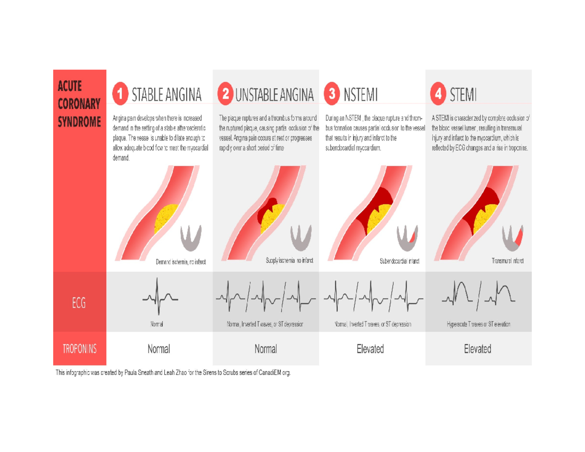 ACS- Angina vs AMI - n/a - NURS 2211 - Studocu
