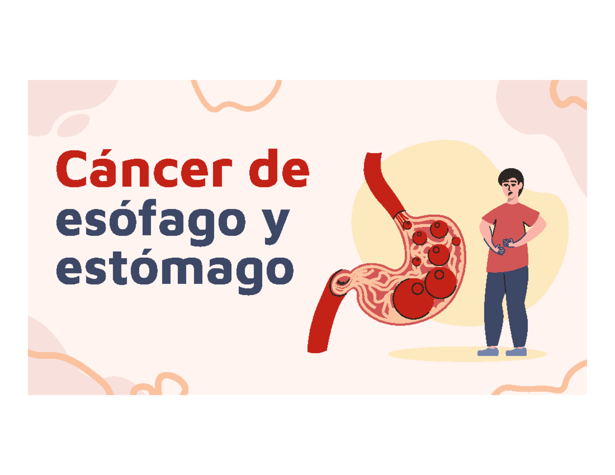 Cáncer gástrico - Cáncer de esófago y estómago Camille Báez Perla ...