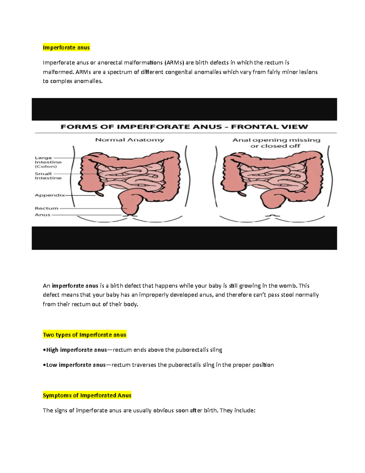 Imperforate ANUS ( Tutup Gilberto AND Tamano Loyda) - Imperforate anus ...