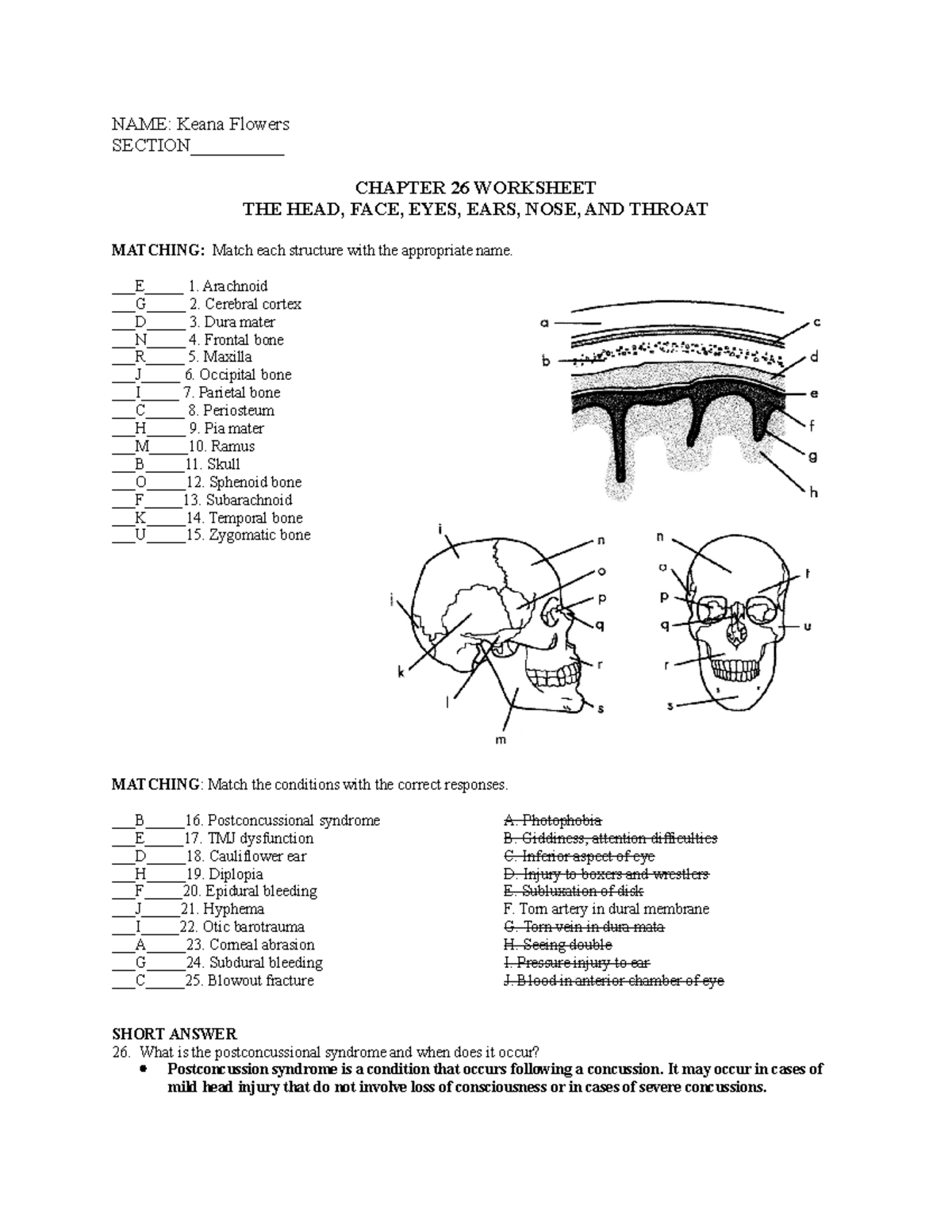 Gen Med-Ch.26 Worksheet - NAME: Keana Flowers SECTION__________ CHAPTER ...