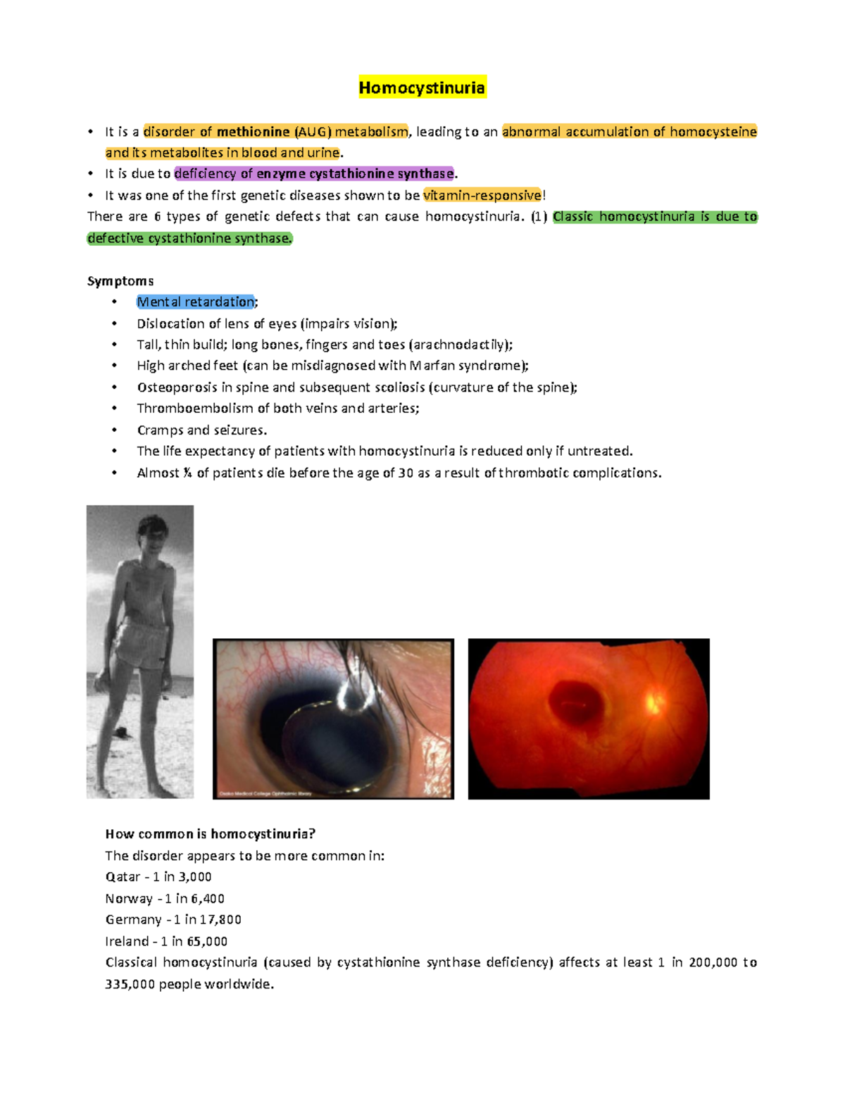7 Lecture-Homocystinuria, a1AT, Hypercholesterolemia - Homocystinuria ...