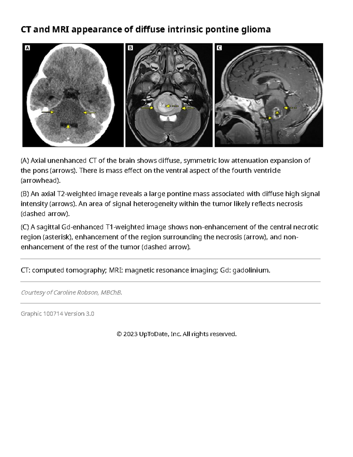 Default(34) - CT and MRI Images - CT and MRI appearance of diffuse ...