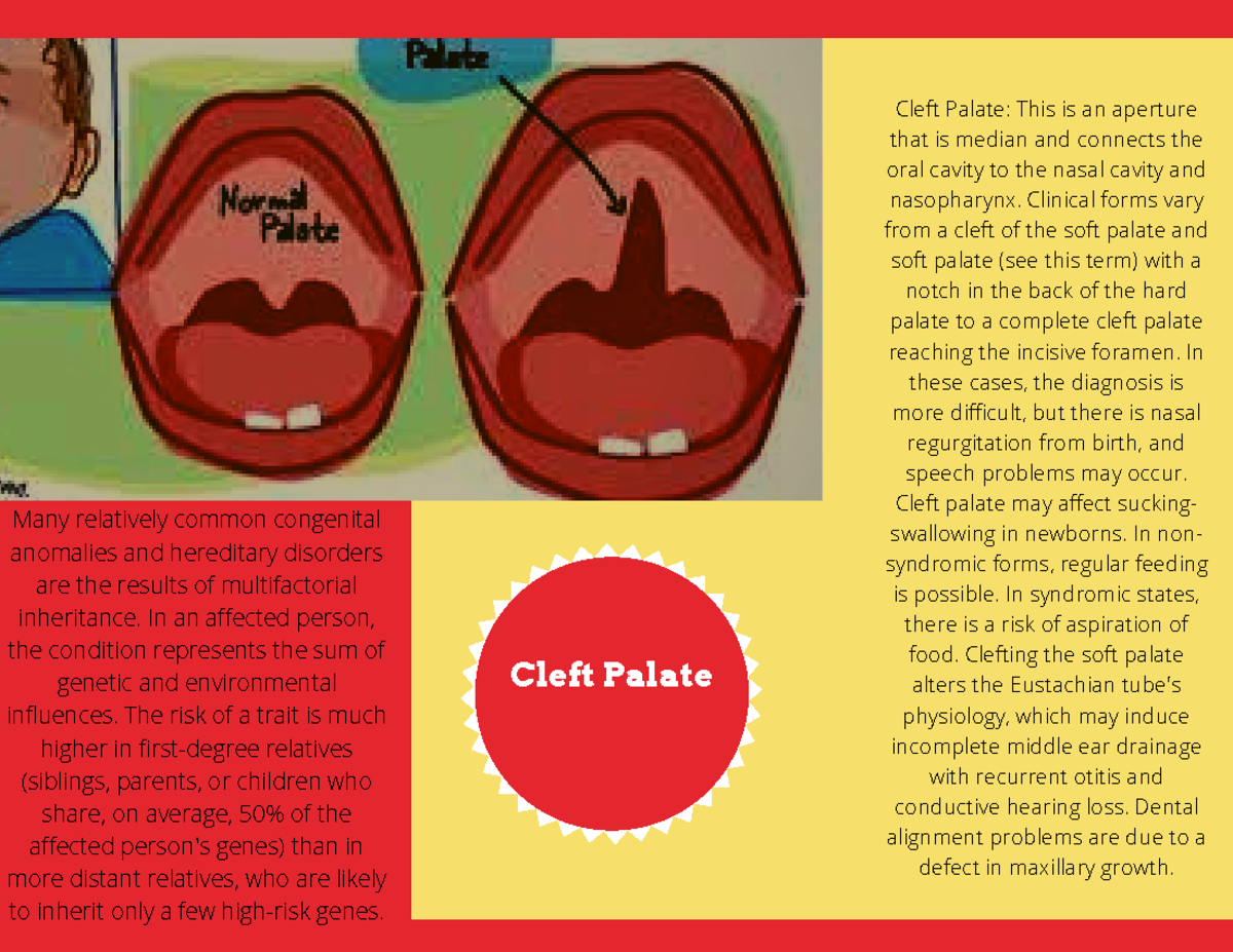 Cleft Palate classwork - BIOL 261 - Studocu