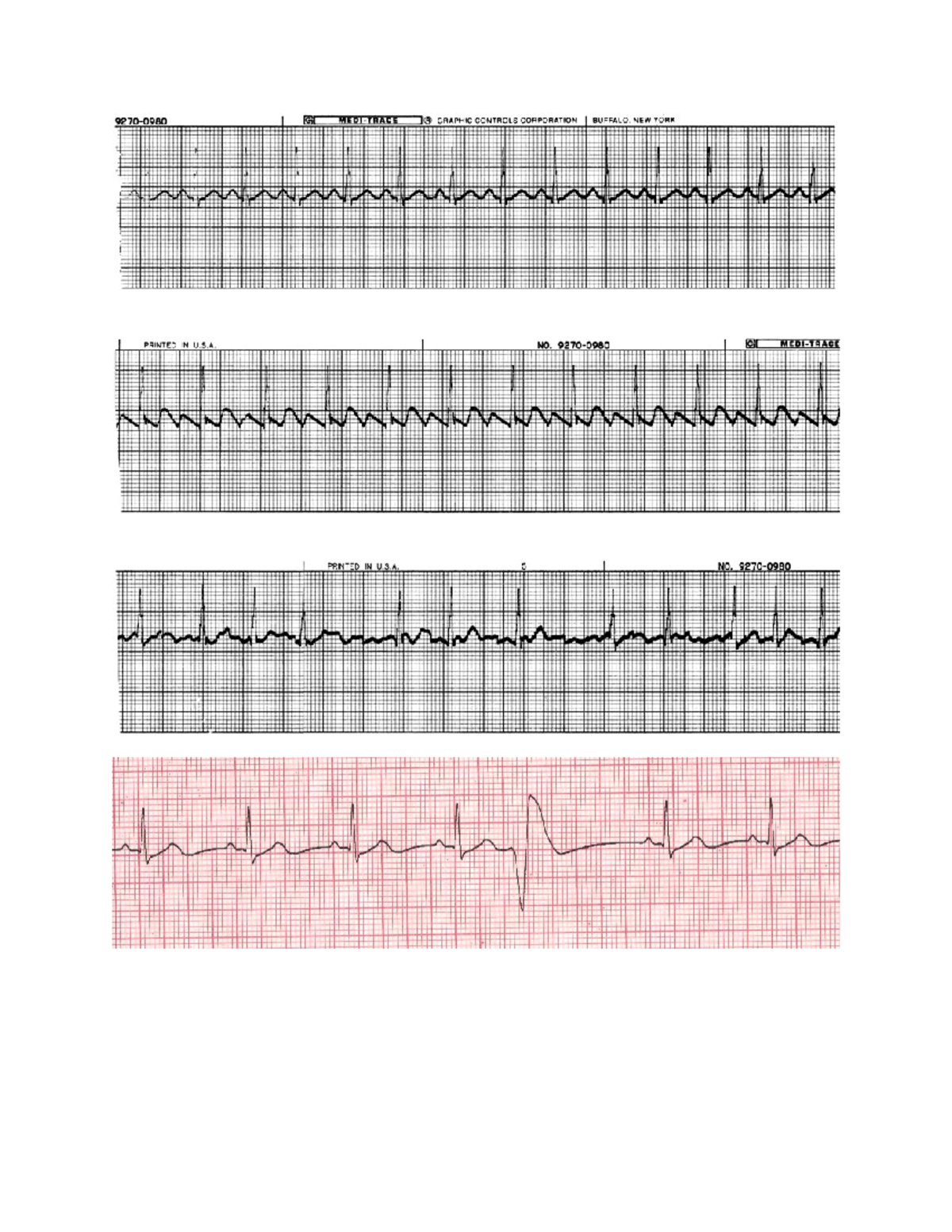 EKG strips - EKG practice - NUR 4110 - GRAPHIC CONTROLS CORPORATION ...