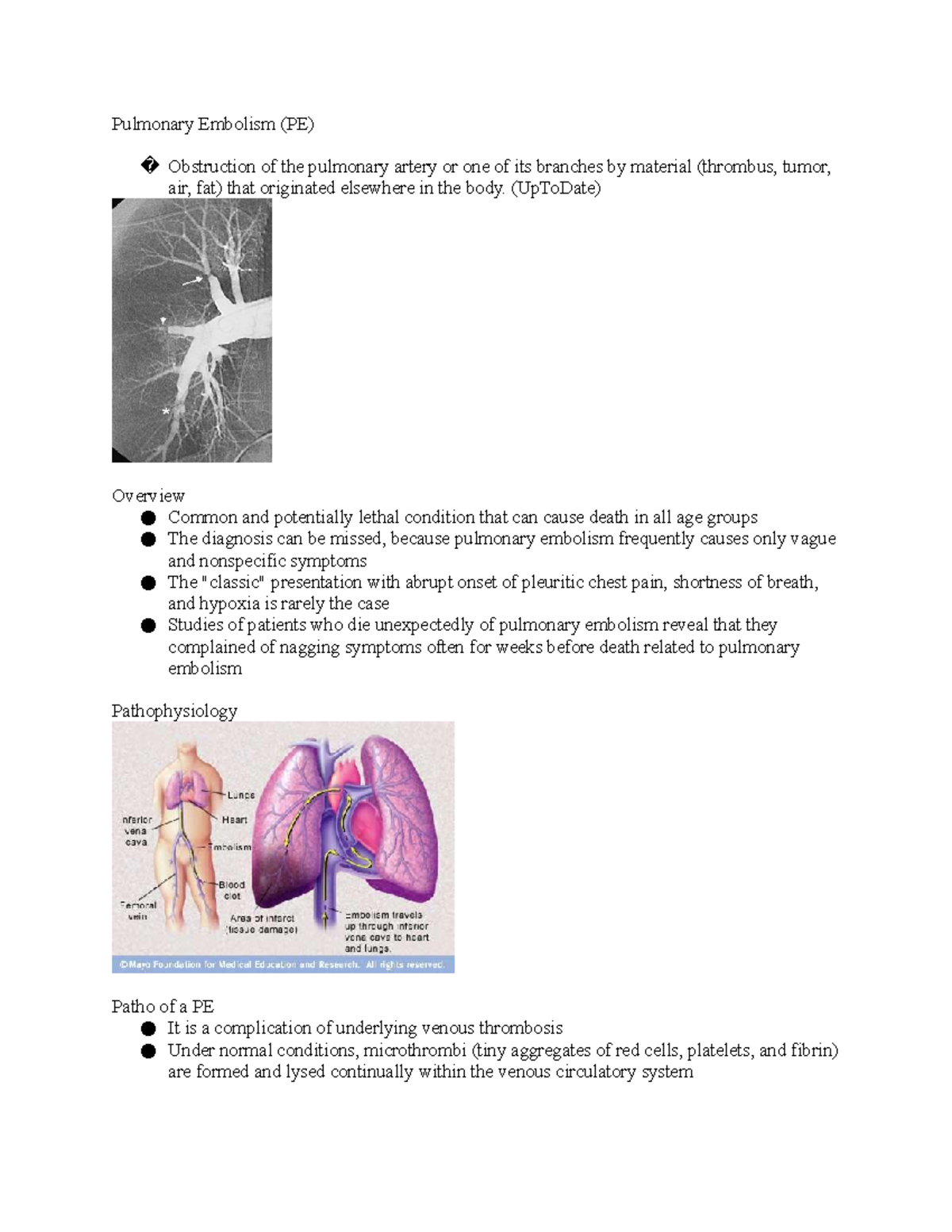 Pulmonary Embolism - lecture notes - Pulmonary Embolism (PE ...