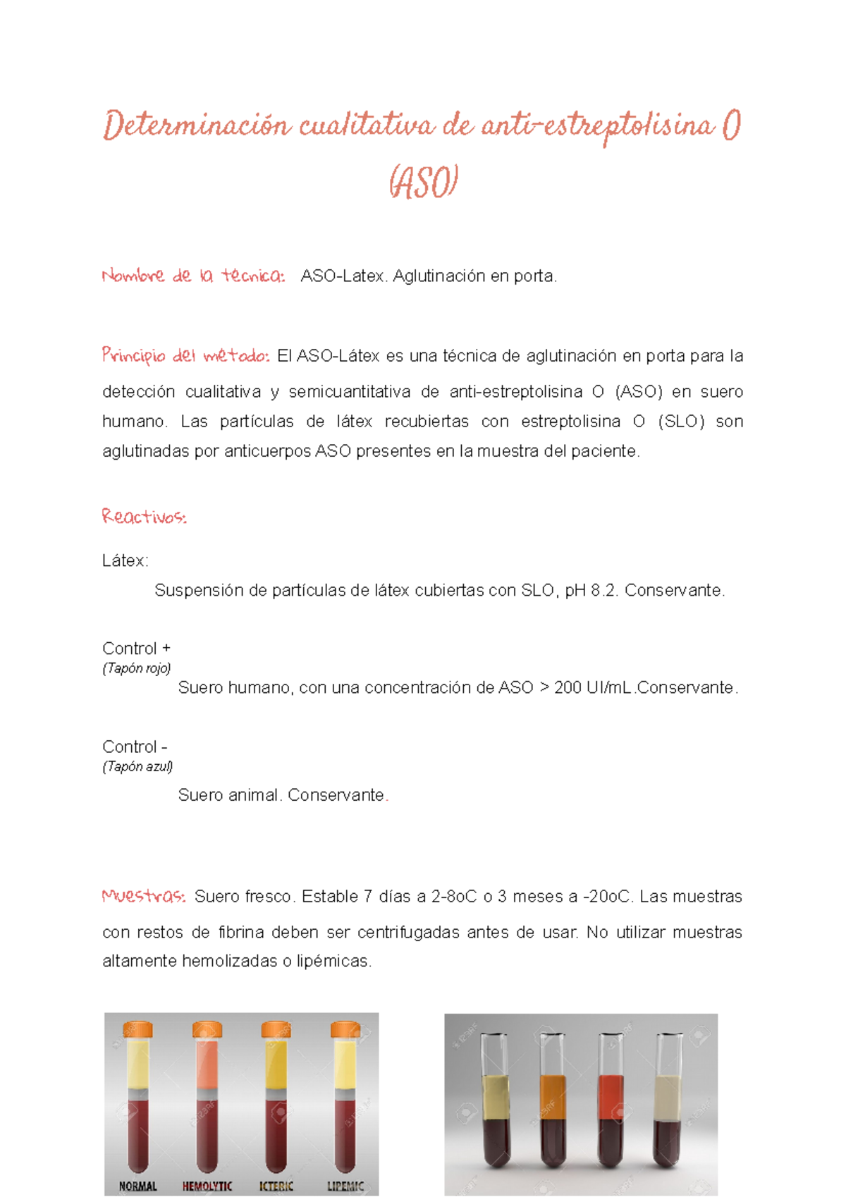 Determinación cualitativa de anti-estreptolisina O (ASO ...