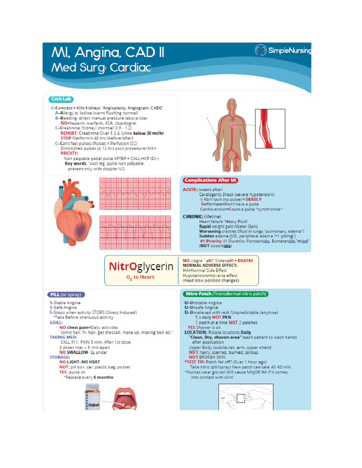 CAD - edm - MI, Angina, CAD II SimpleNursing Med Surg: Cardiac Cath Lab ...