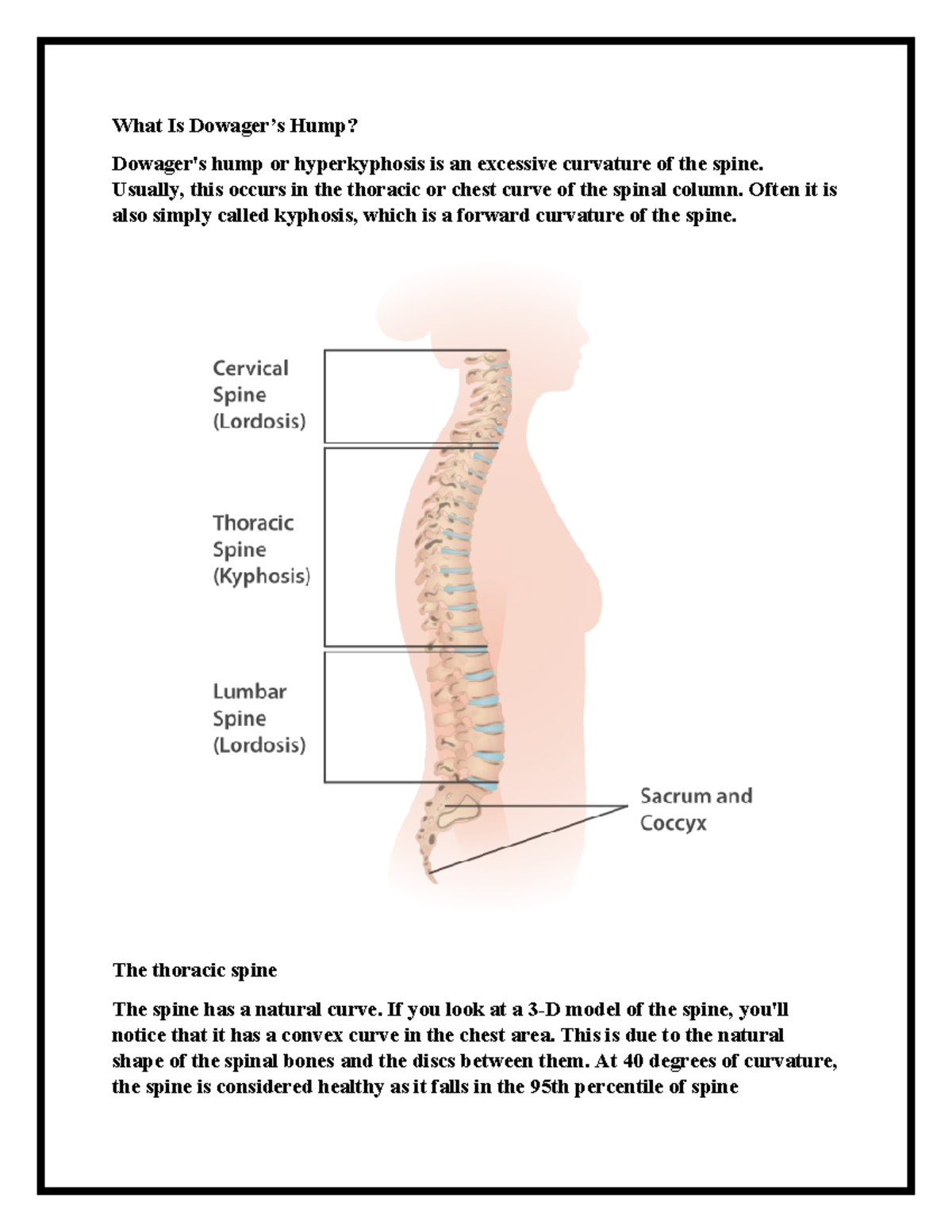 Degenerative Disc Disease - What Is Dowager’s Hump? Dowager's hump or ...