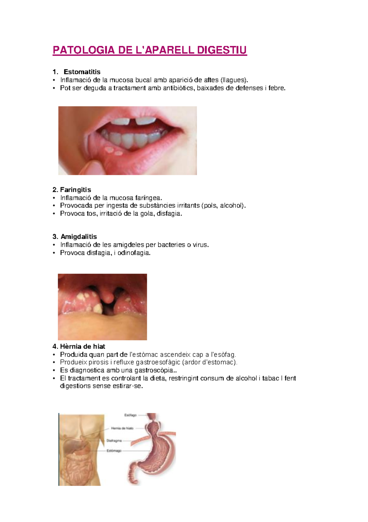 Sistema digestivo - GRAN REPASO - PATOLOGIA DE L'APARELL DIGESTIU ...