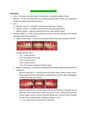 Gingivostomatitis Herpetik Sekunder dan Gingivitis Nekrotik ...