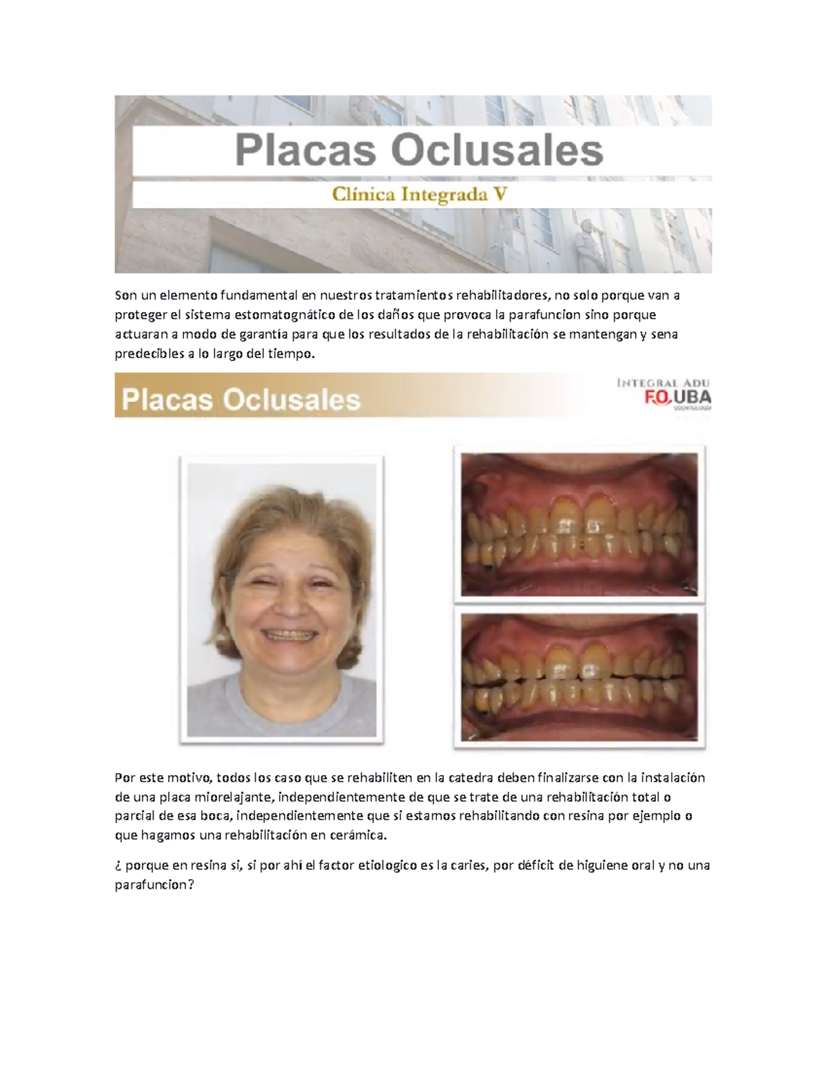 14° Placas Oclusales - Odontologia - Son un elemento fundamental en ...