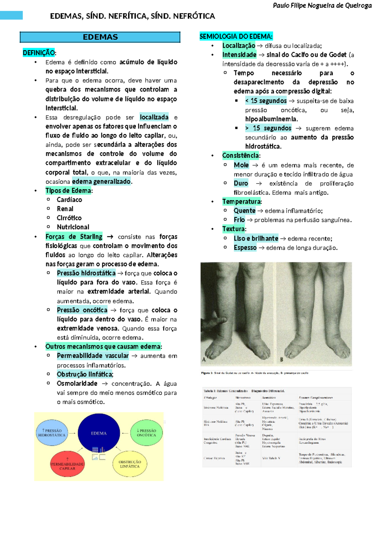 SP 1.5 - Edemas, Sindrome Nefritica, SIND Nefrótica - 1 EDEMAS, SÍND ...
