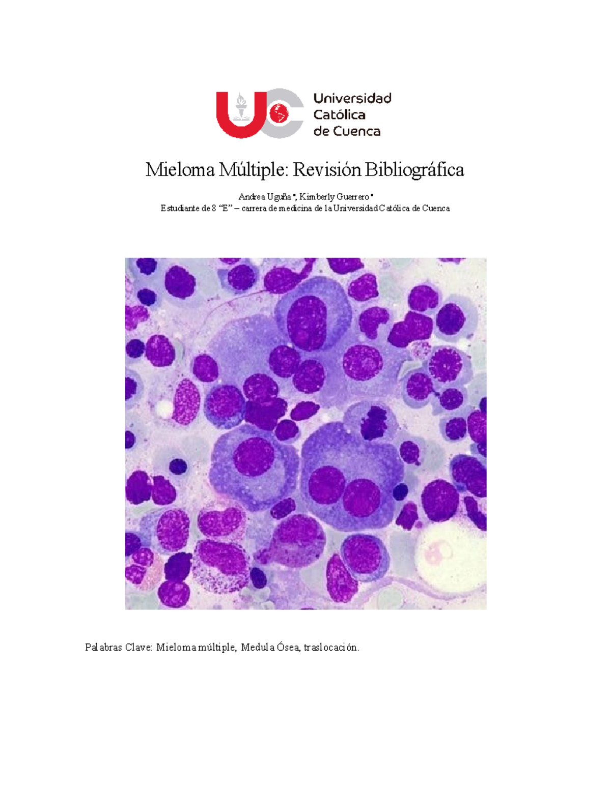 Revisión Mieloma M - Mieloma Múltiple: Revisión Bibliográfica Andrea ...