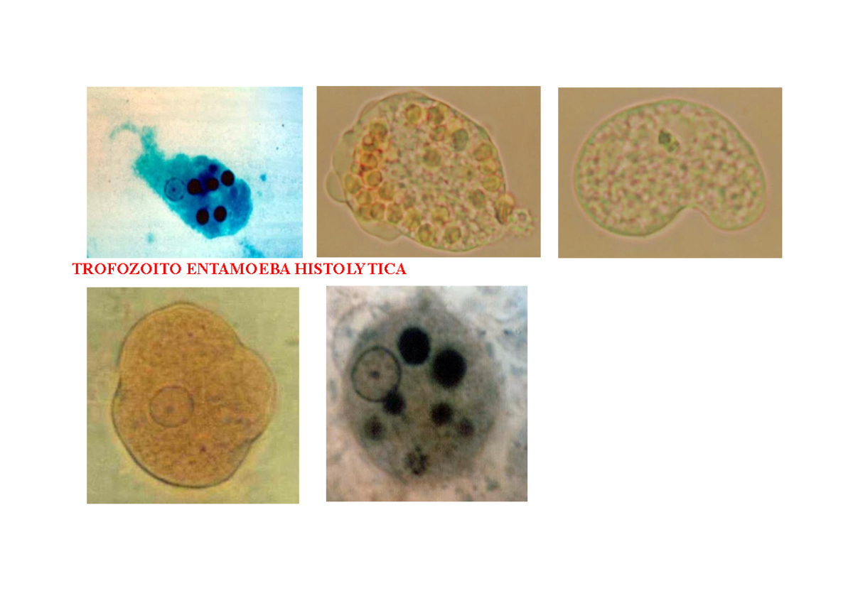 KKCK - KOKMLM - TROFOZOITO ENTAMOEBA HISTOLYTICA QUISTE ENTAMOEBA ...