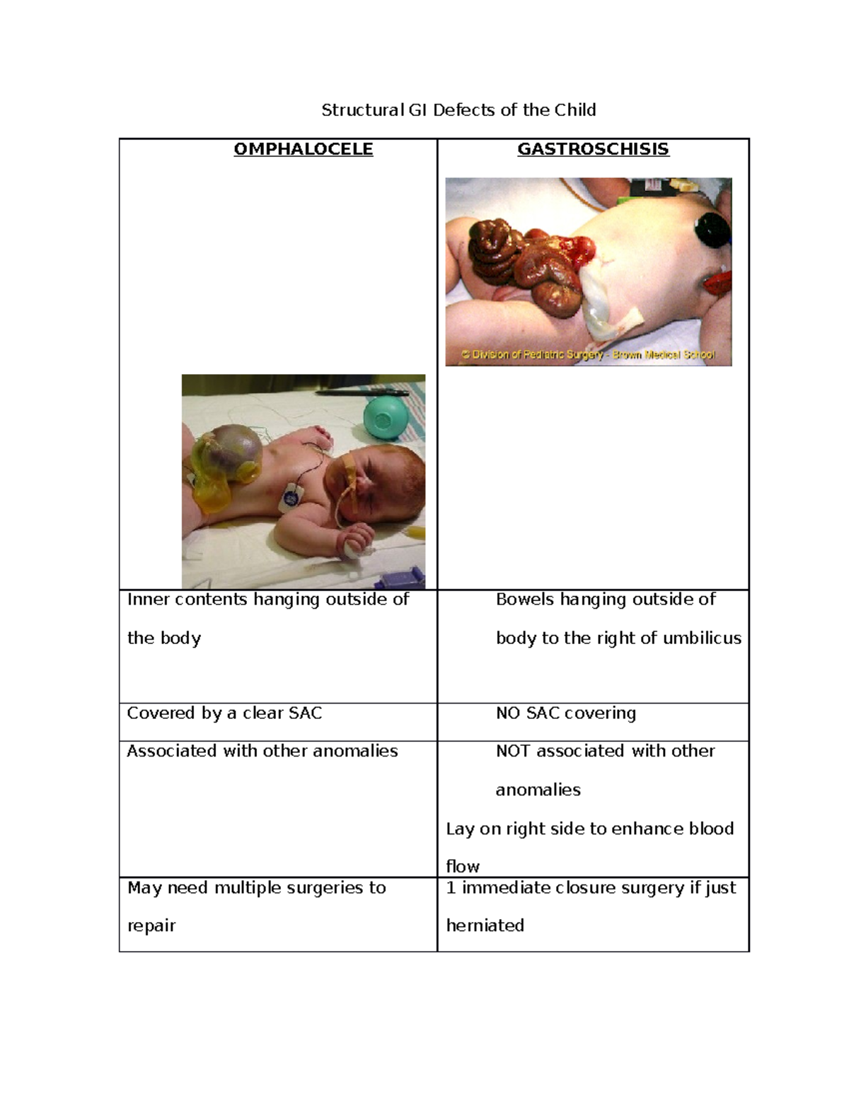 Week 1 Content Peds (GI,Renal) - Structural GI Defects of the Child ...