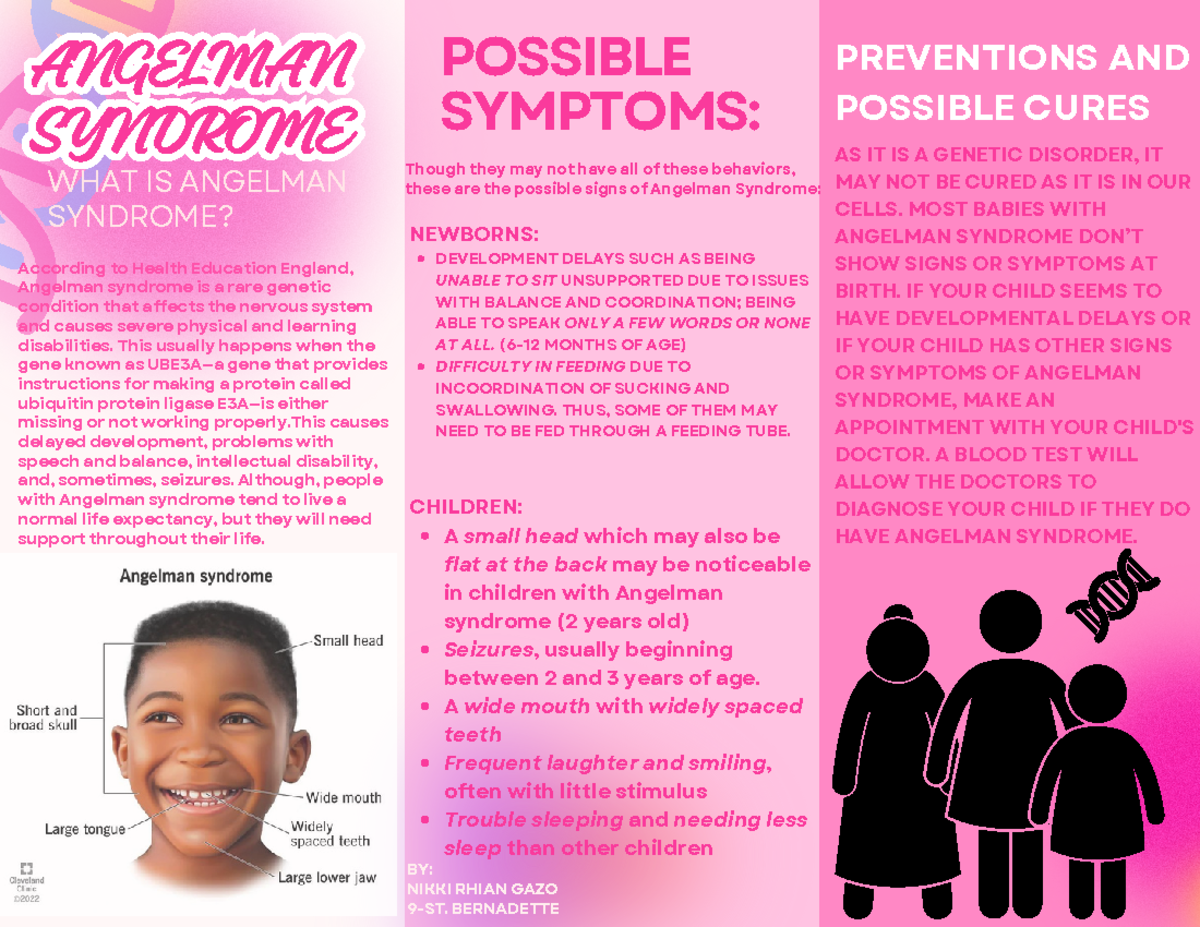 Angelman- Syndrome - ANGELMAN SYNDROME ANGELMAN SYNDROME According to ...