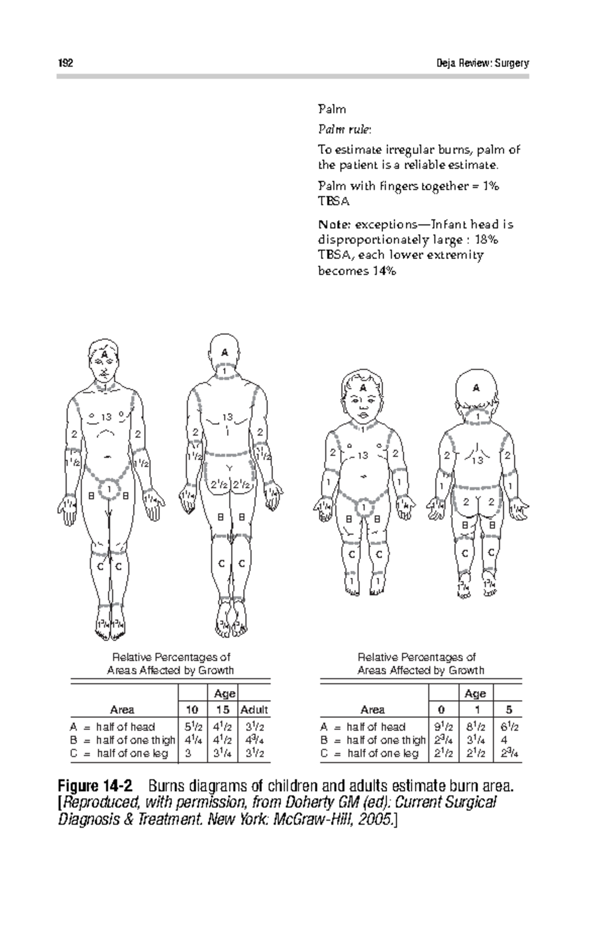 Deja review surgery 24 - Cours - Palm Palm rule: To estimate irregular ...