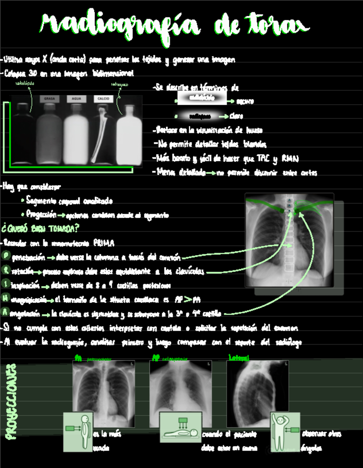 Radiografía de torax - ad ⑧ grana de torox rayos X onda corta para ...