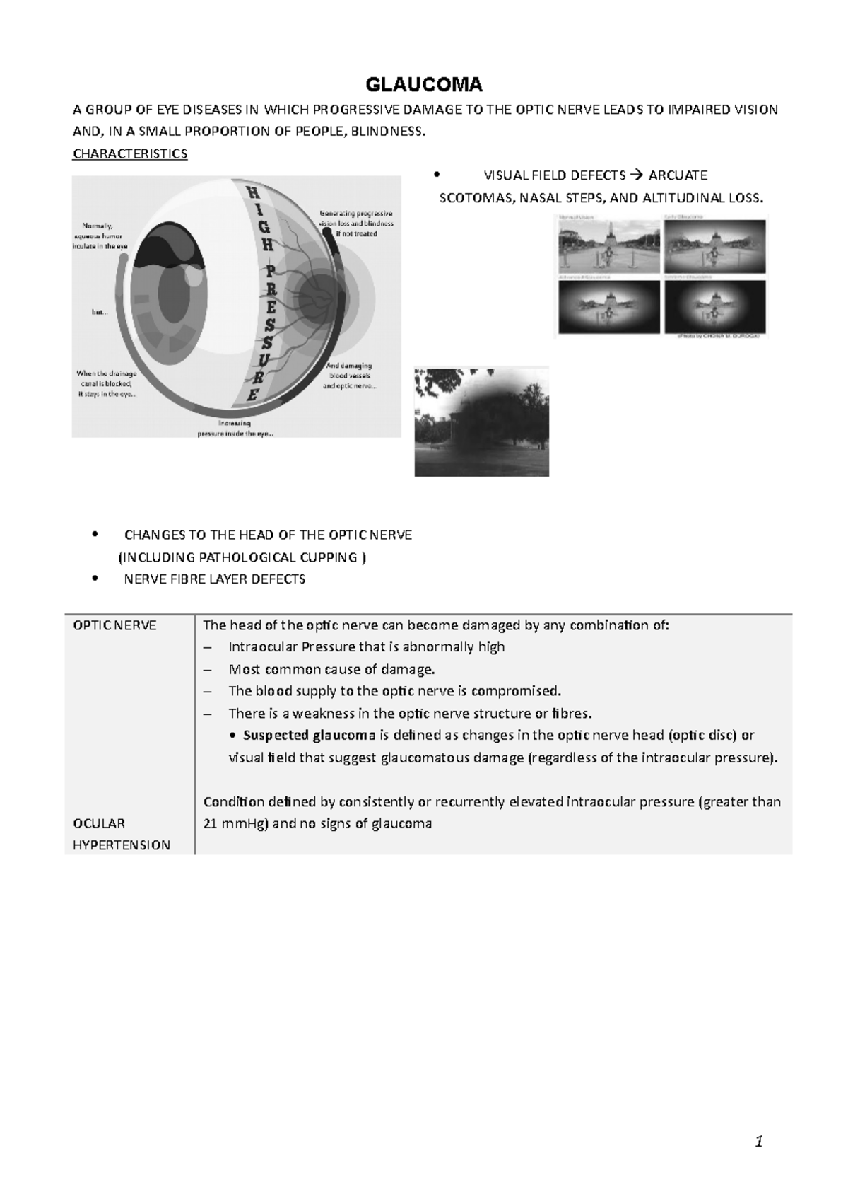 Glaucoma - Summaries and revision note base on lecture note in MPHM07 ...
