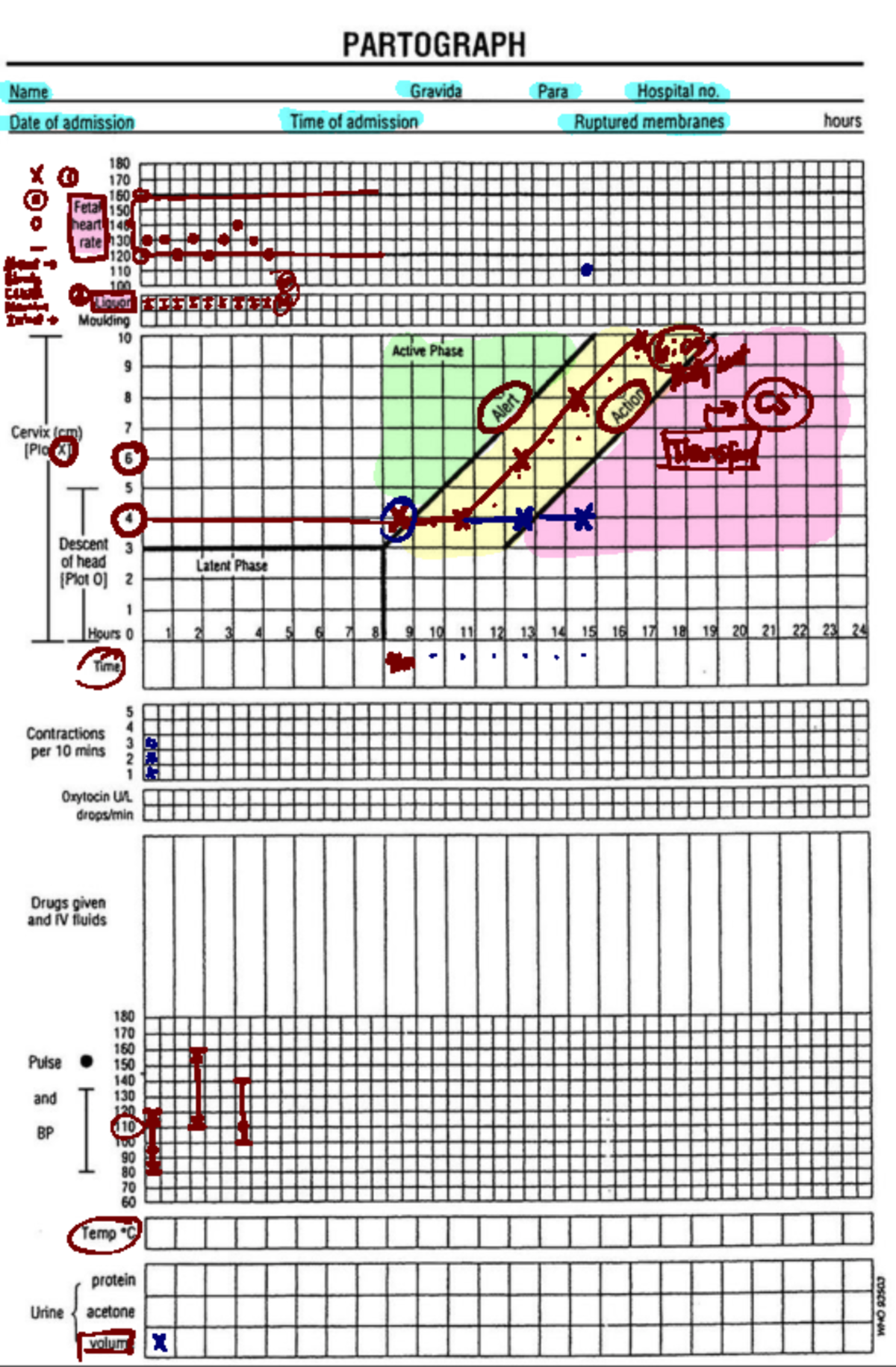 Composite Partograph WHO 1994 - PARTOGRAPH Name Gravida Para Hospital ...