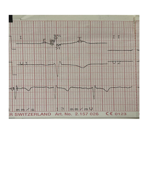 Actividad eléctrica del corazón; corazón “IN SITU” - Composición del ...
