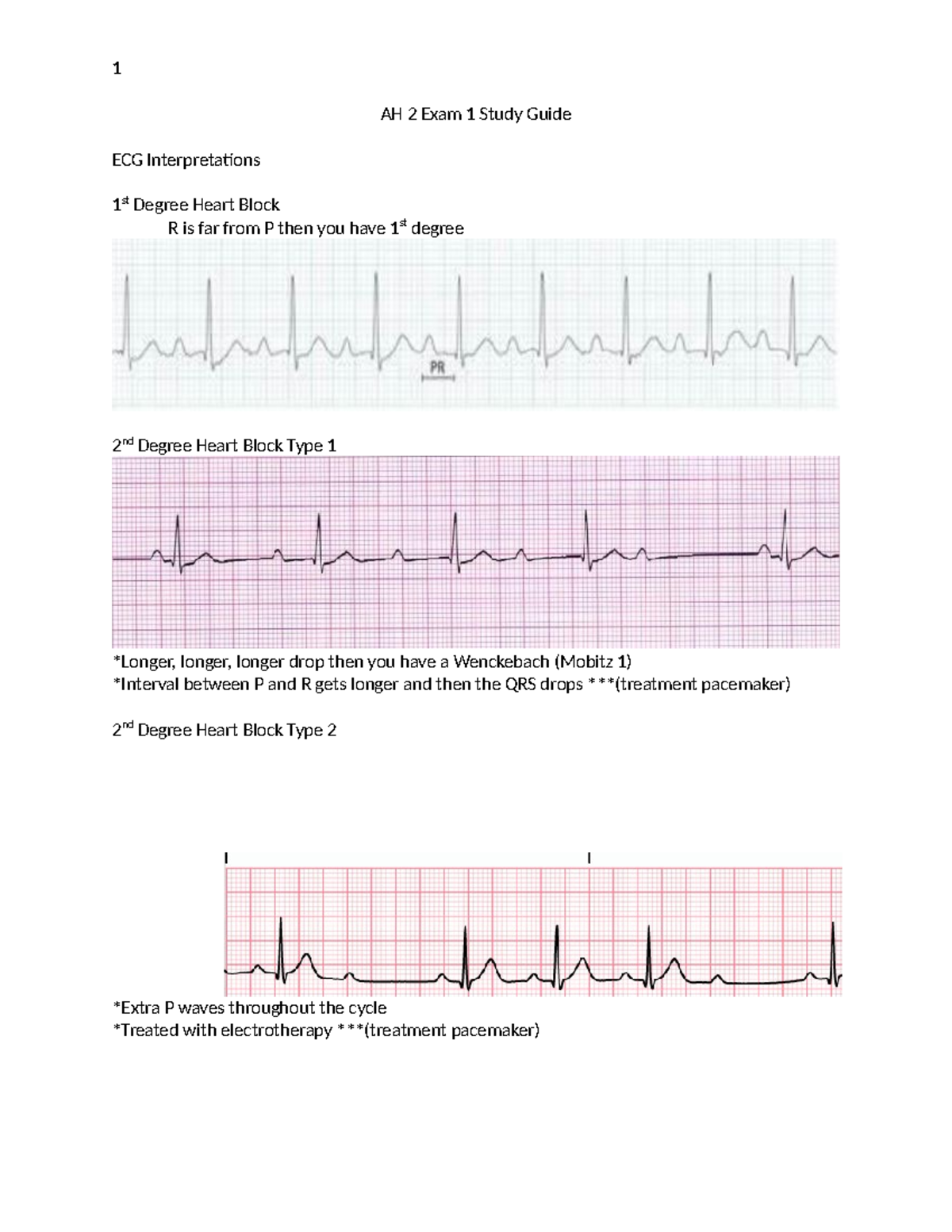 Study Guide Exam 1 - AH 2 Exam 1 Study Guide ECG Interpretations 1 st ...