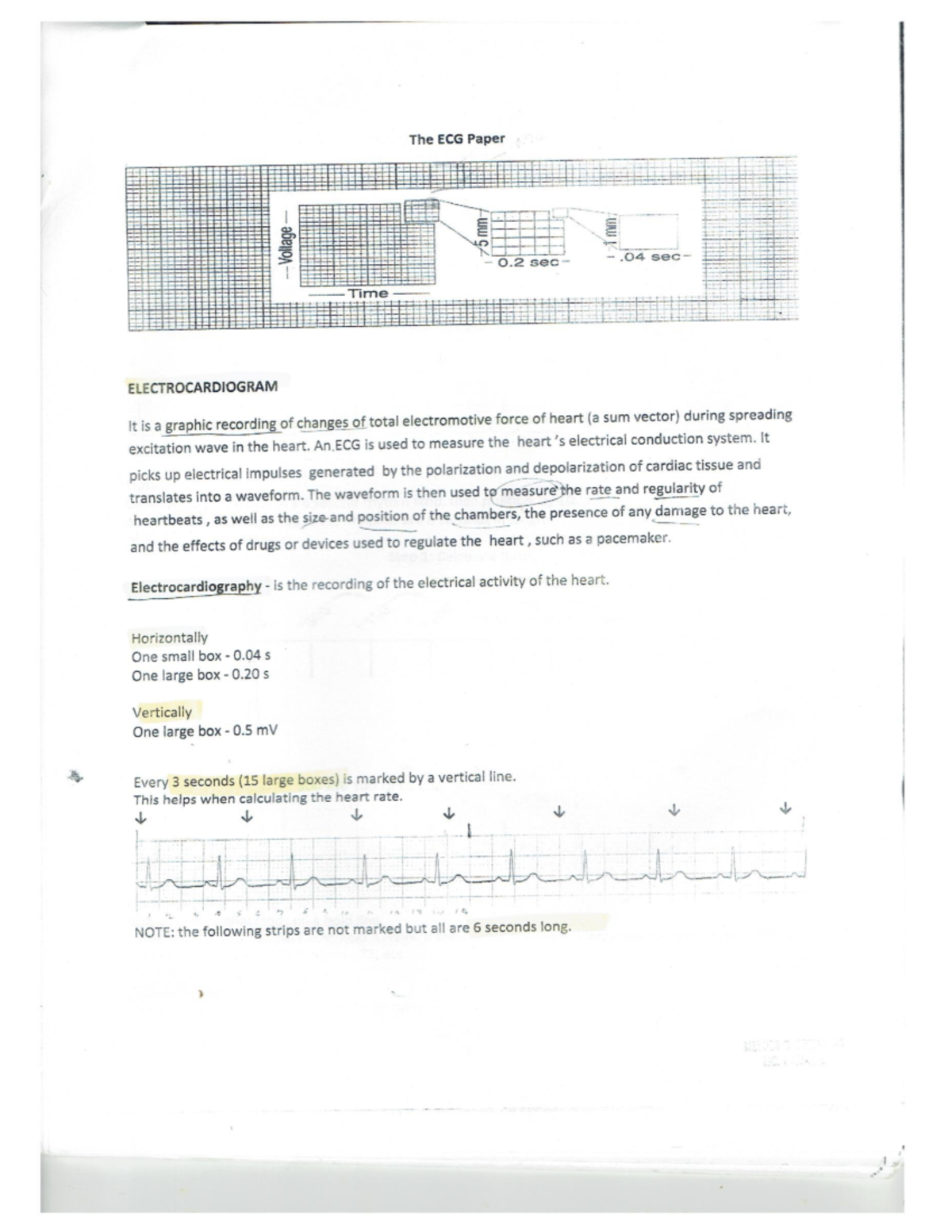 THE ECG Paper for actual identification of the the different waves ...