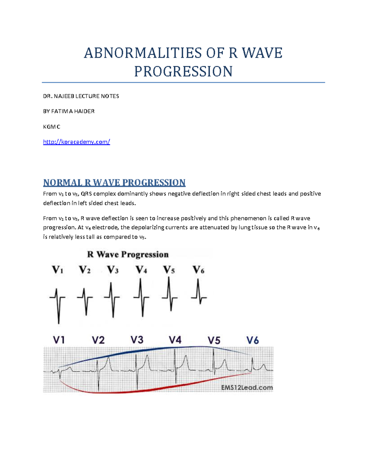 08 - Abnormalities OF R WAVE Progression 0 - ABNORMALITIES OF R WAVE ...