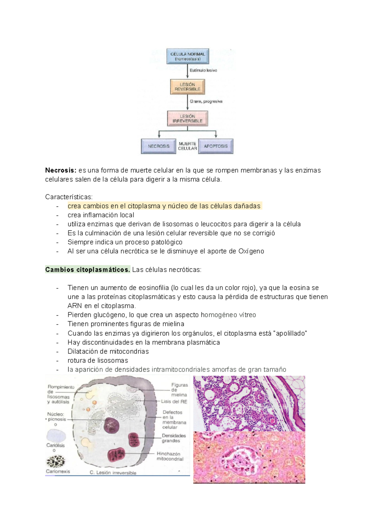 Tipos de necrosis - Necrosis: es una forma de muerte celular en la que ...