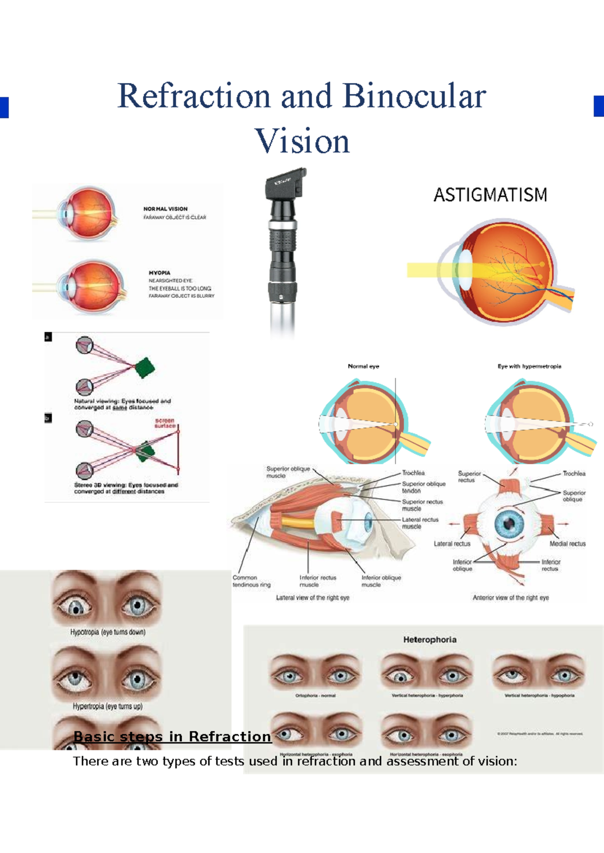 Refraction and Binocular Vision - Refraction and Binocular Vision Basic ...
