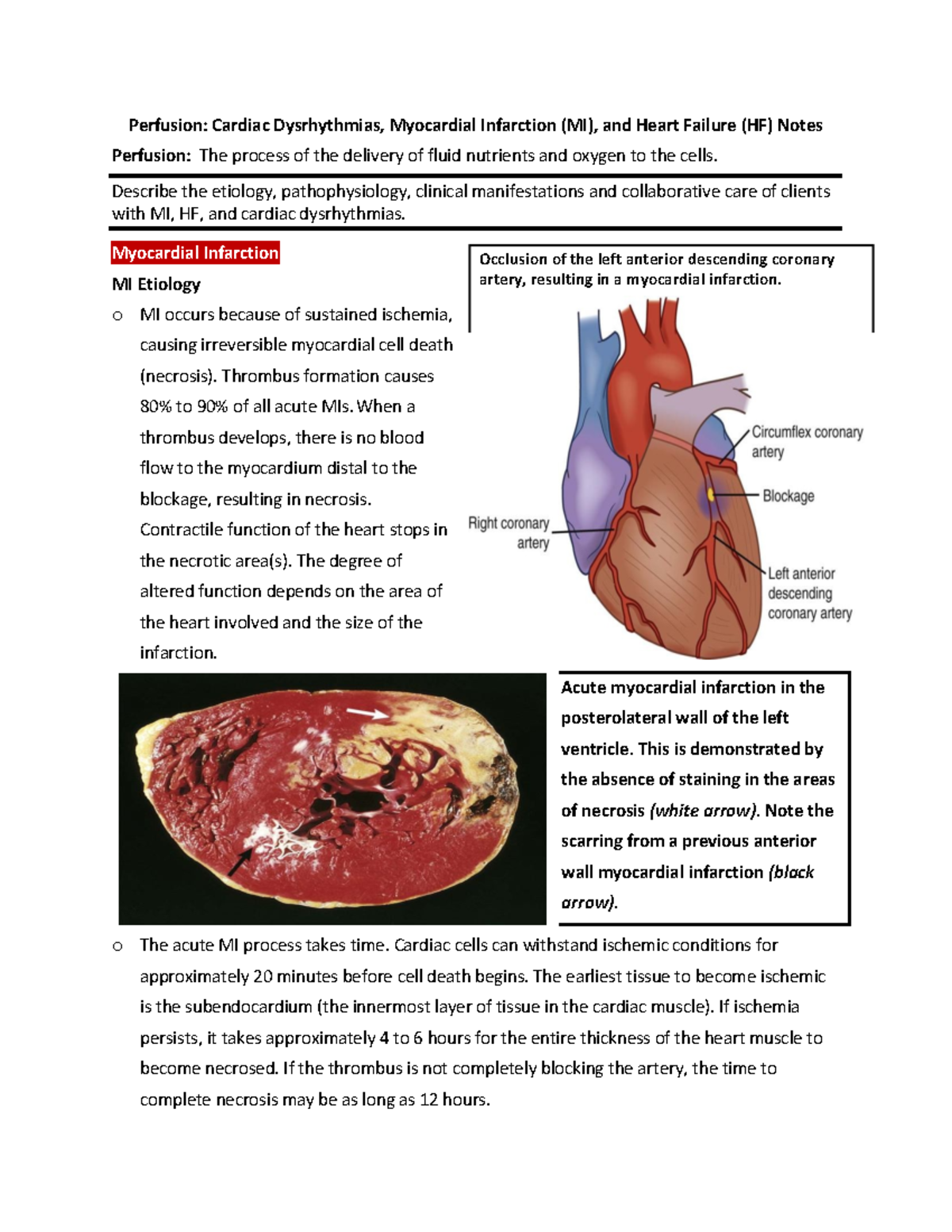 Perfusion Notes - Perfusion: Cardiac Dysrhythmias, Myocardial ...