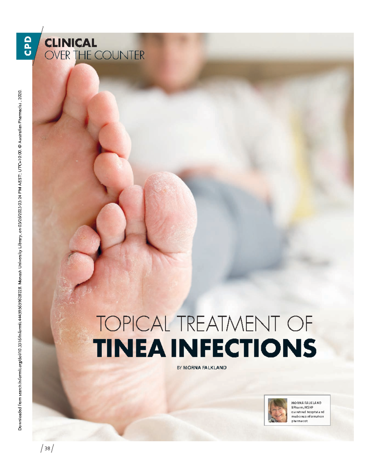 Over the counter Topical treatment of tinea infections - MORNA FALKLAND ...