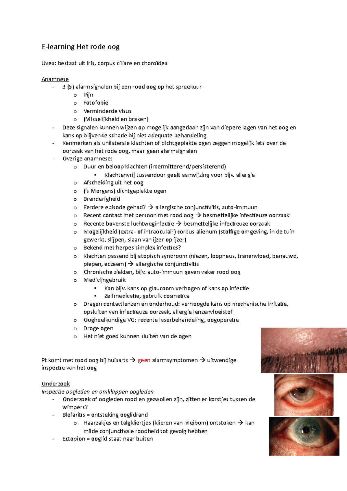 E-learning rood oog - Samenvatting E-learning rood oog - E-learning Het ...