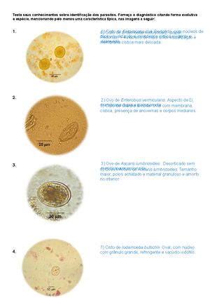 Métodos utilizados no exame parasitológico de Fezes - Métodos ...