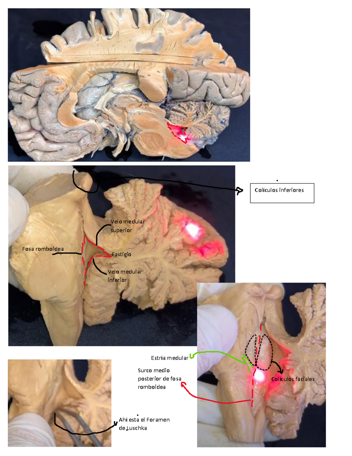Neuro- preparados - Colículos inferiores Velo medular superior Velo ...