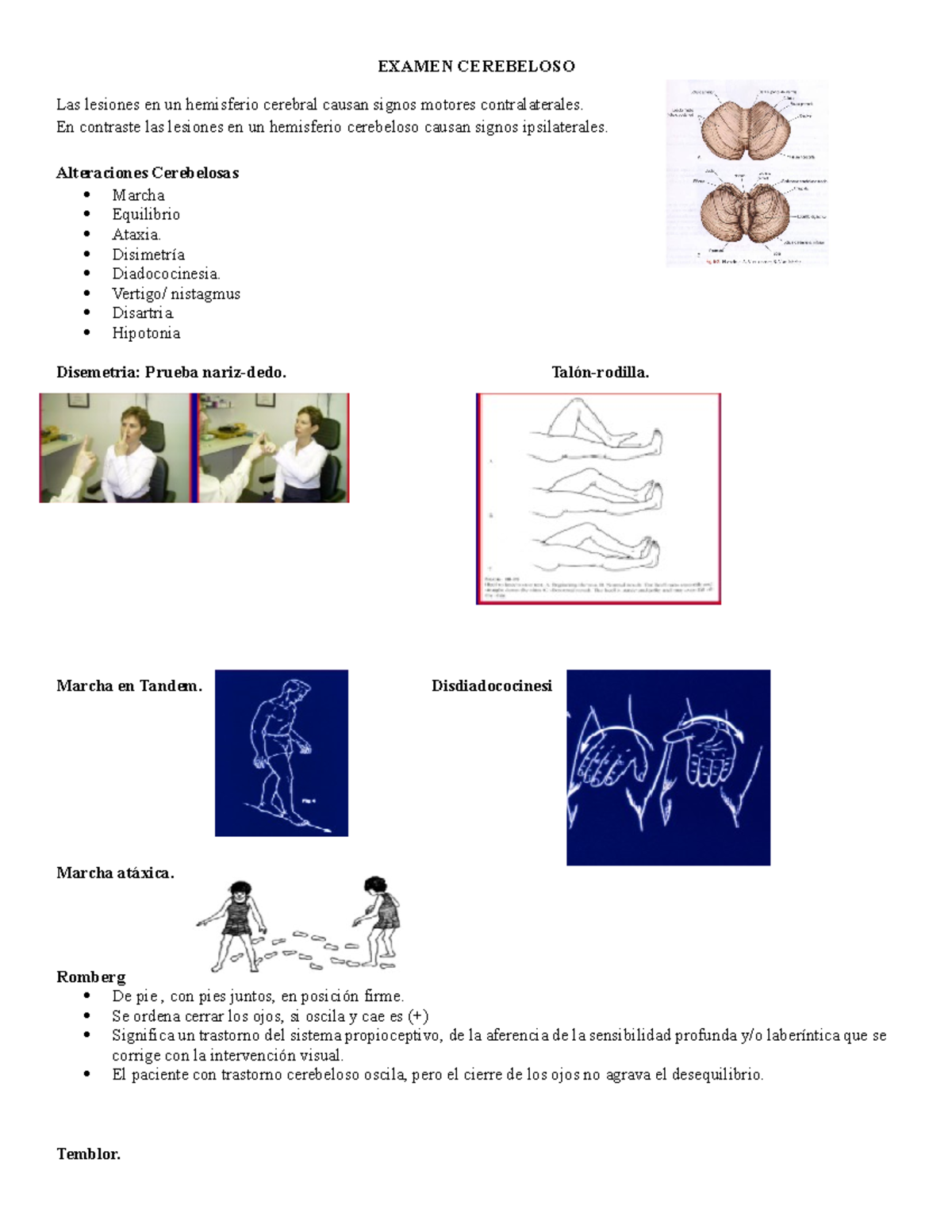 Examen cerebeloso - EXAMEN CEREBELOSO Las lesiones en un hemisferio ...