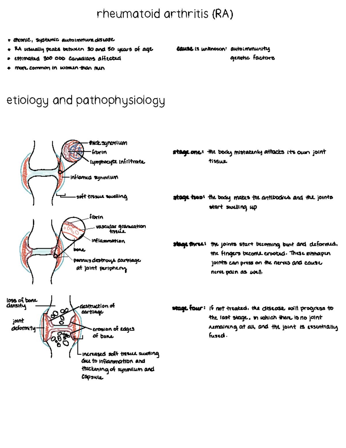 Rheumatoid arthritis cheat sheet - rheumatoid arthritis (RA) etiology ...