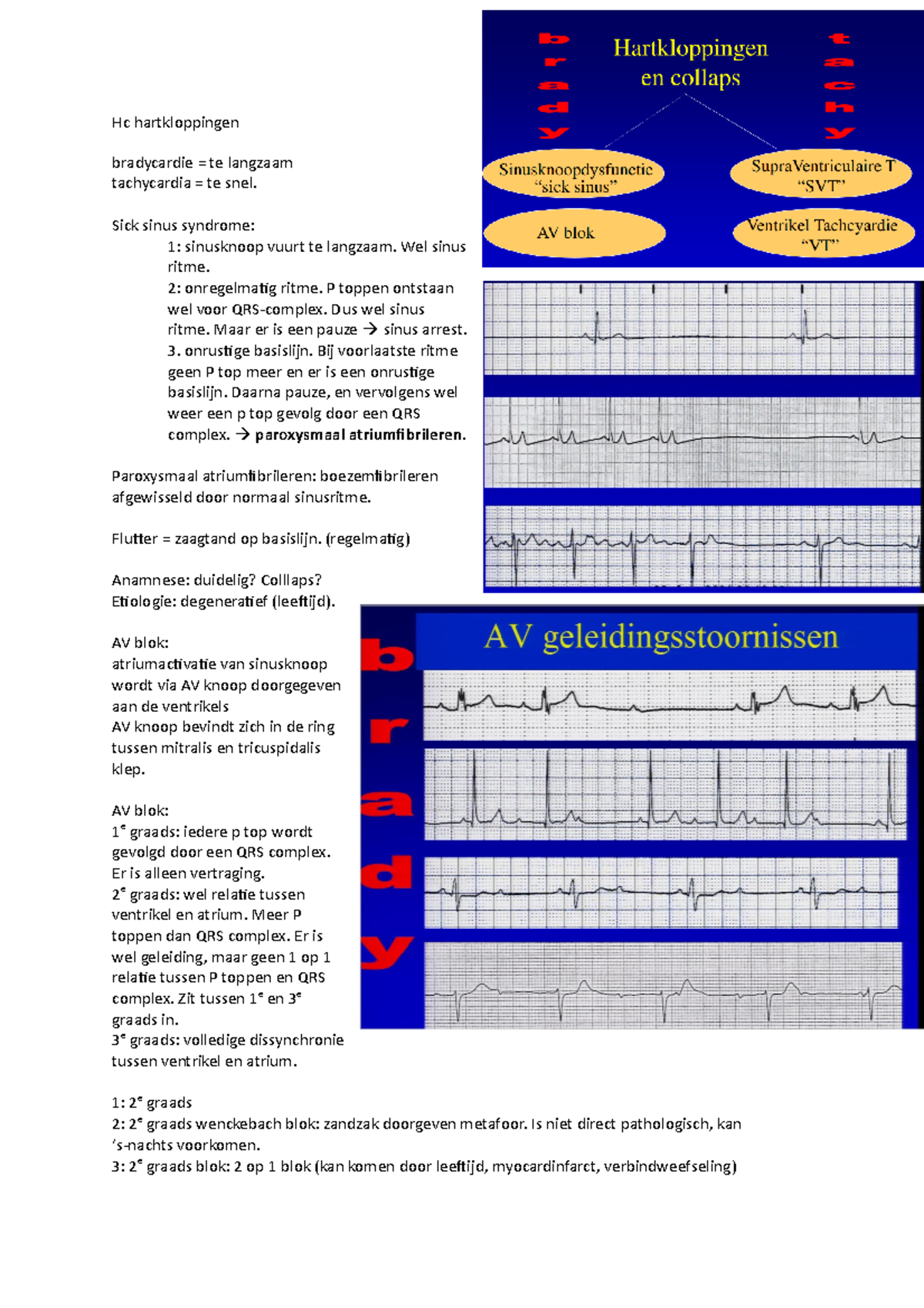 Hc hartkloppingen - samenvatting college - Hc hartkloppingen ...