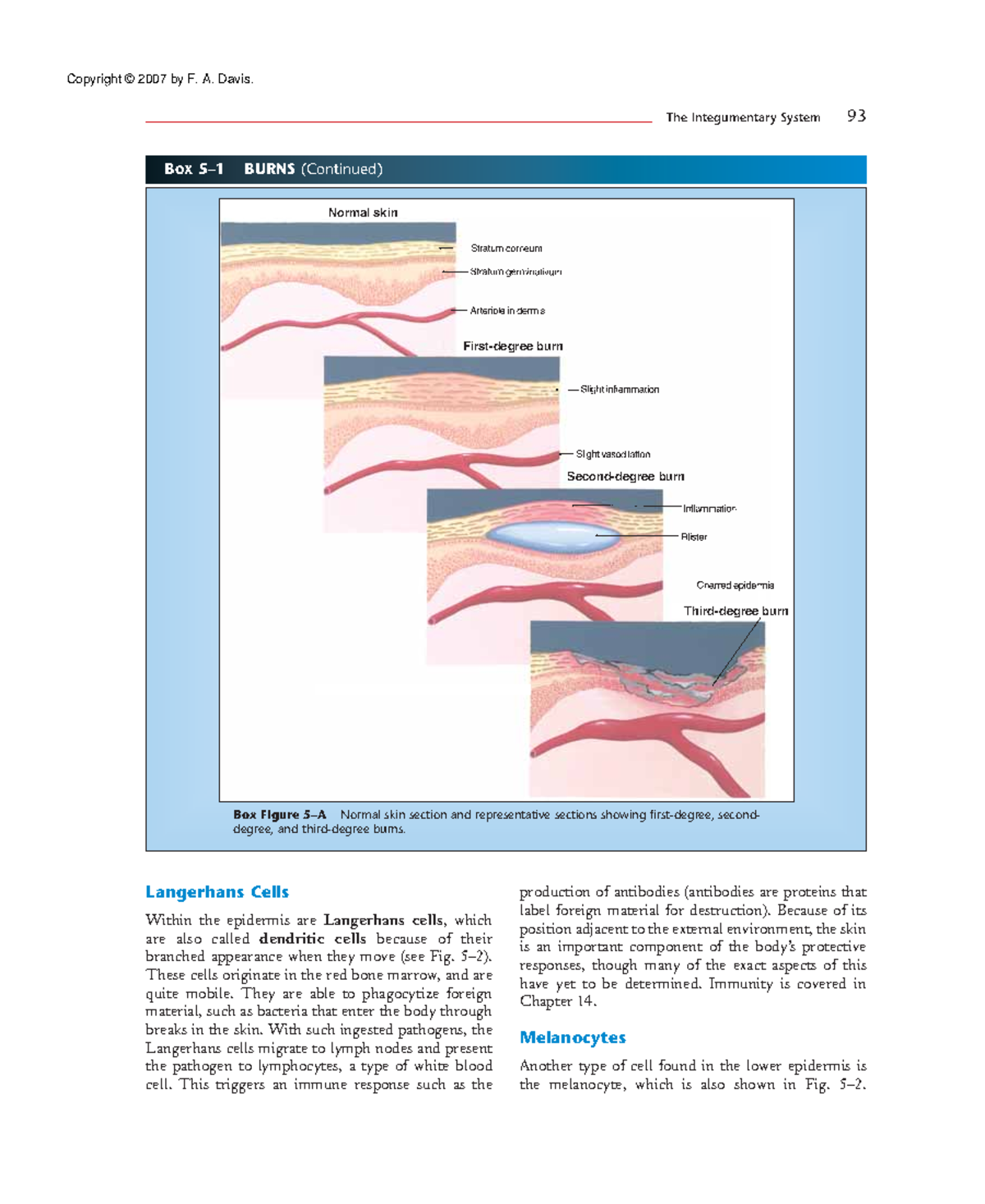 Anatomy and Physiology (12) - The Integumentary System 93 BOX 5–1 BURNS ...