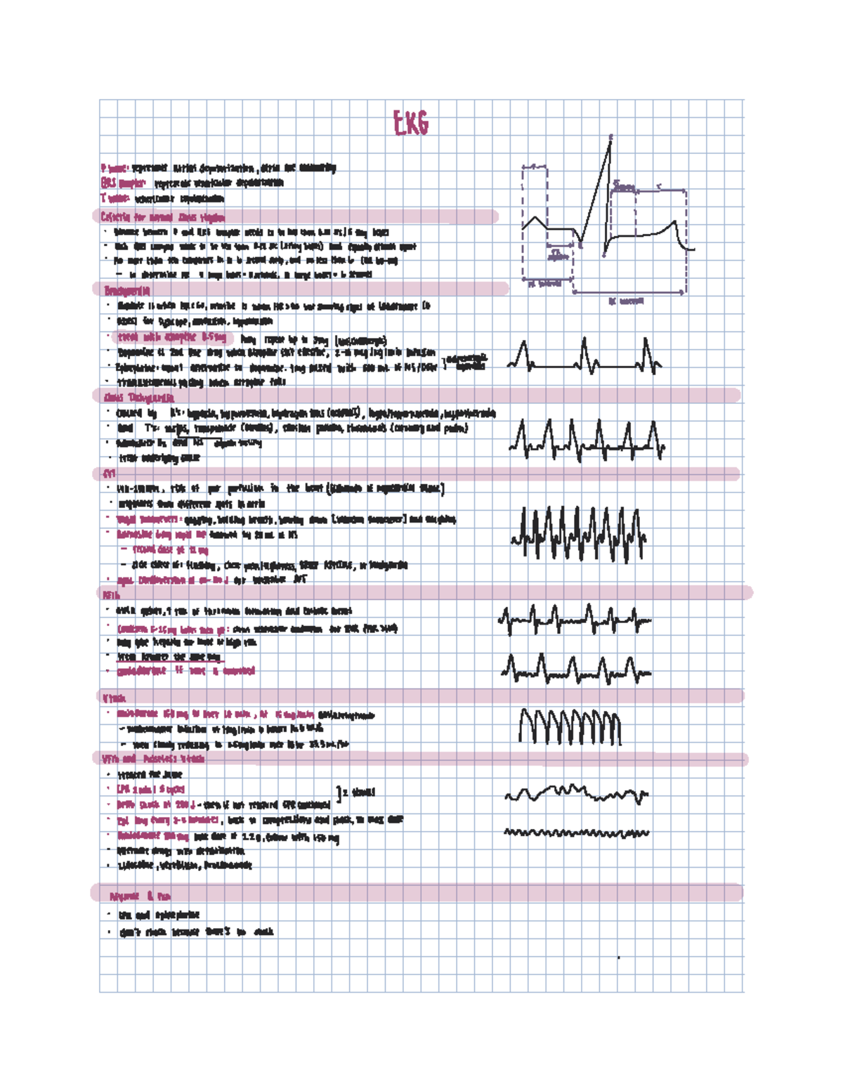 EKG - critical care nursing - EKG P wave represents atrial ...