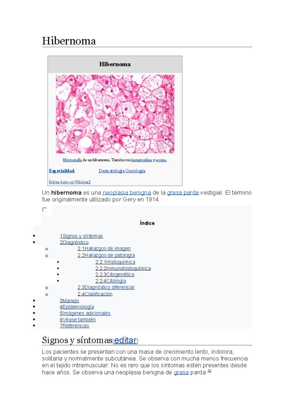 Hibernoma - APUNTES - Hibernoma Hibernoma Micrografía de un hibernoma ...