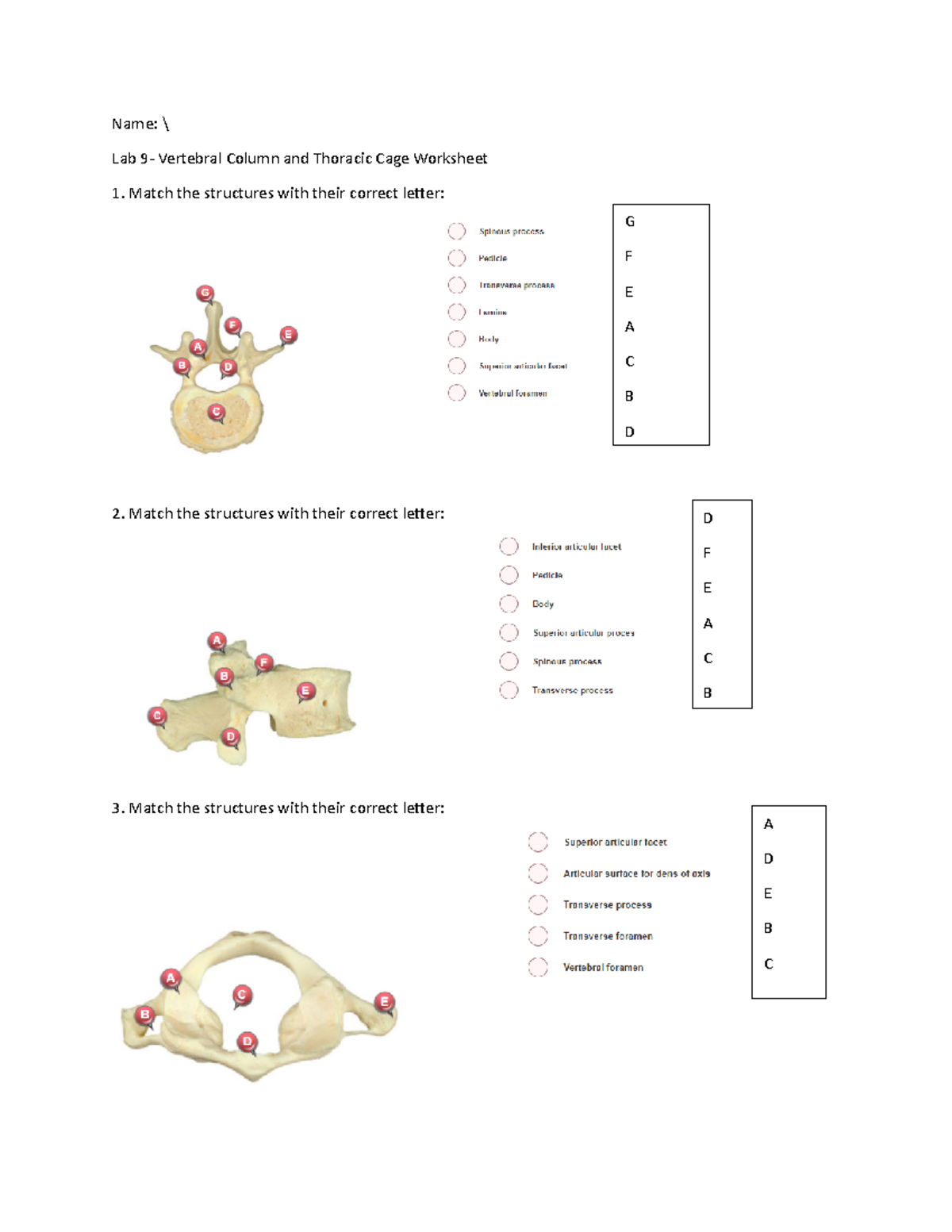 9 - Vertebral Column and Thoracic Cage - The joints between the ...