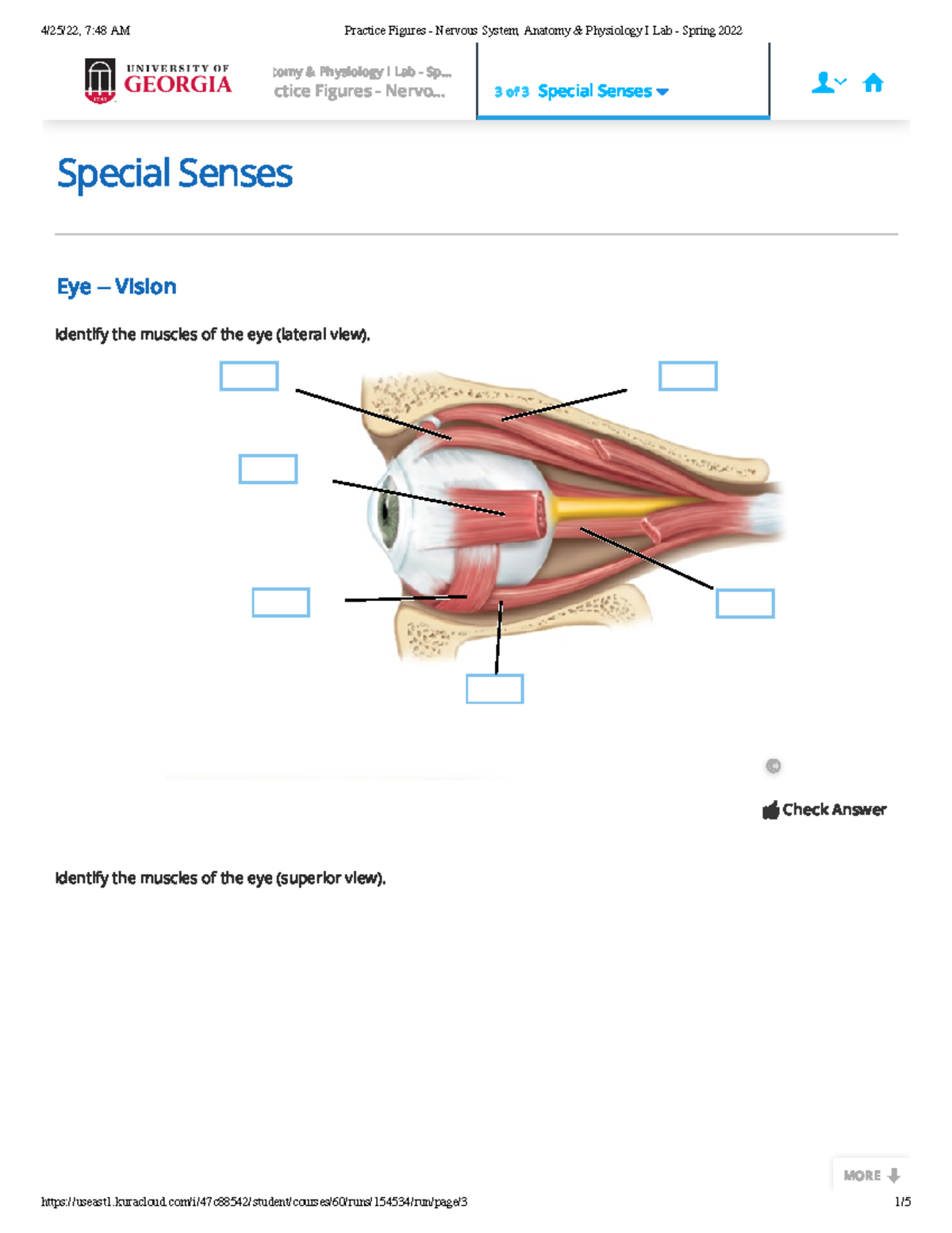 Special senses - practice material - Special Senses Eye - Vision ...