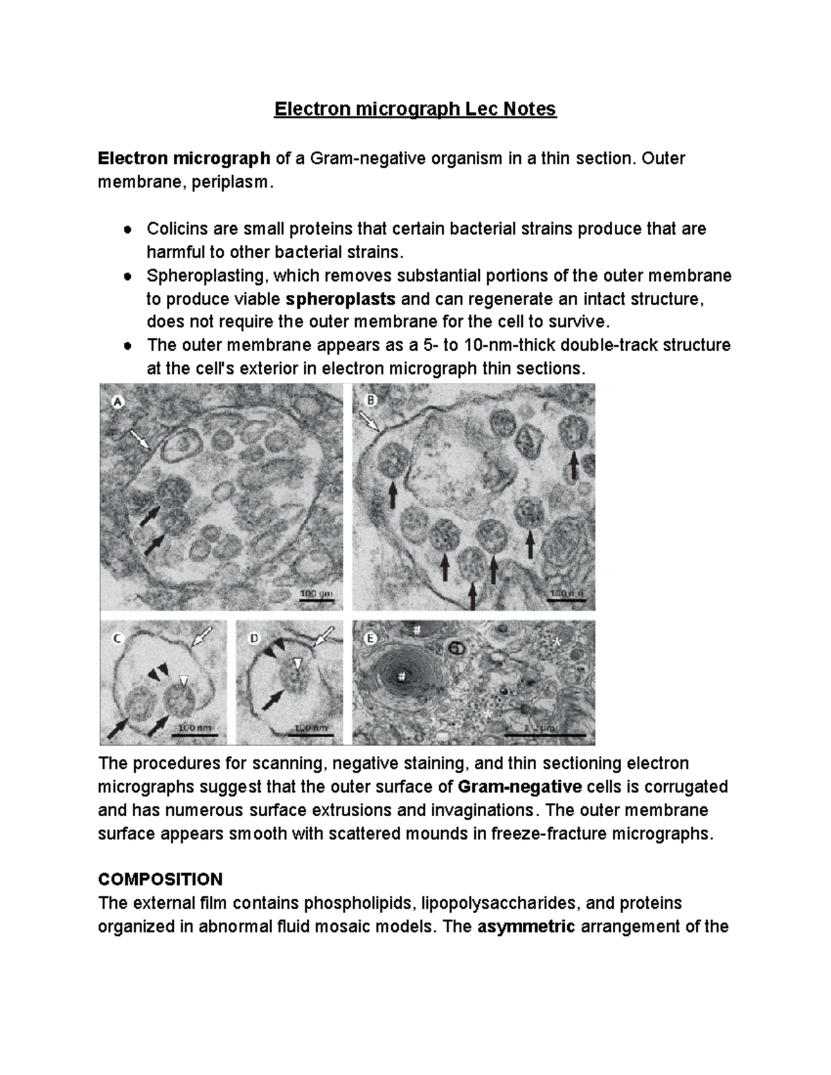 Electron micrograph Lec Notes - Electron micrograph Lec Notes Electron ...