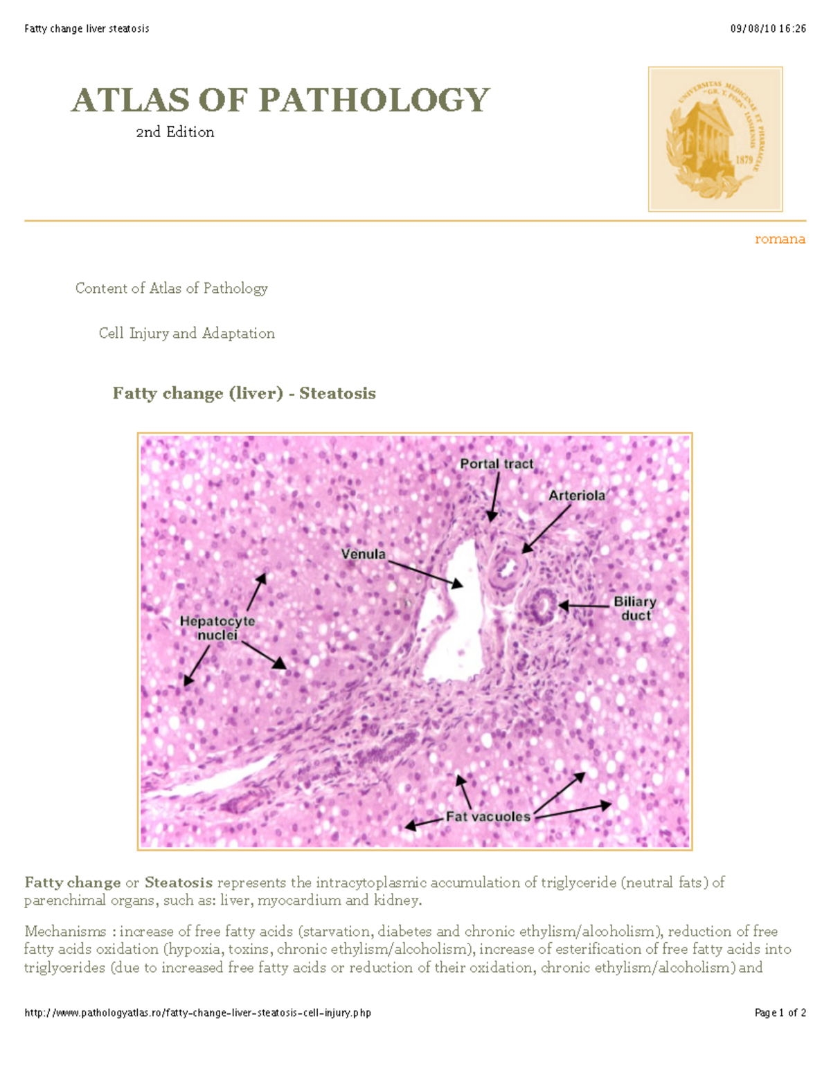 Fatty change liver steatosis - php Page 1 of 2 Content of Atlas of ...