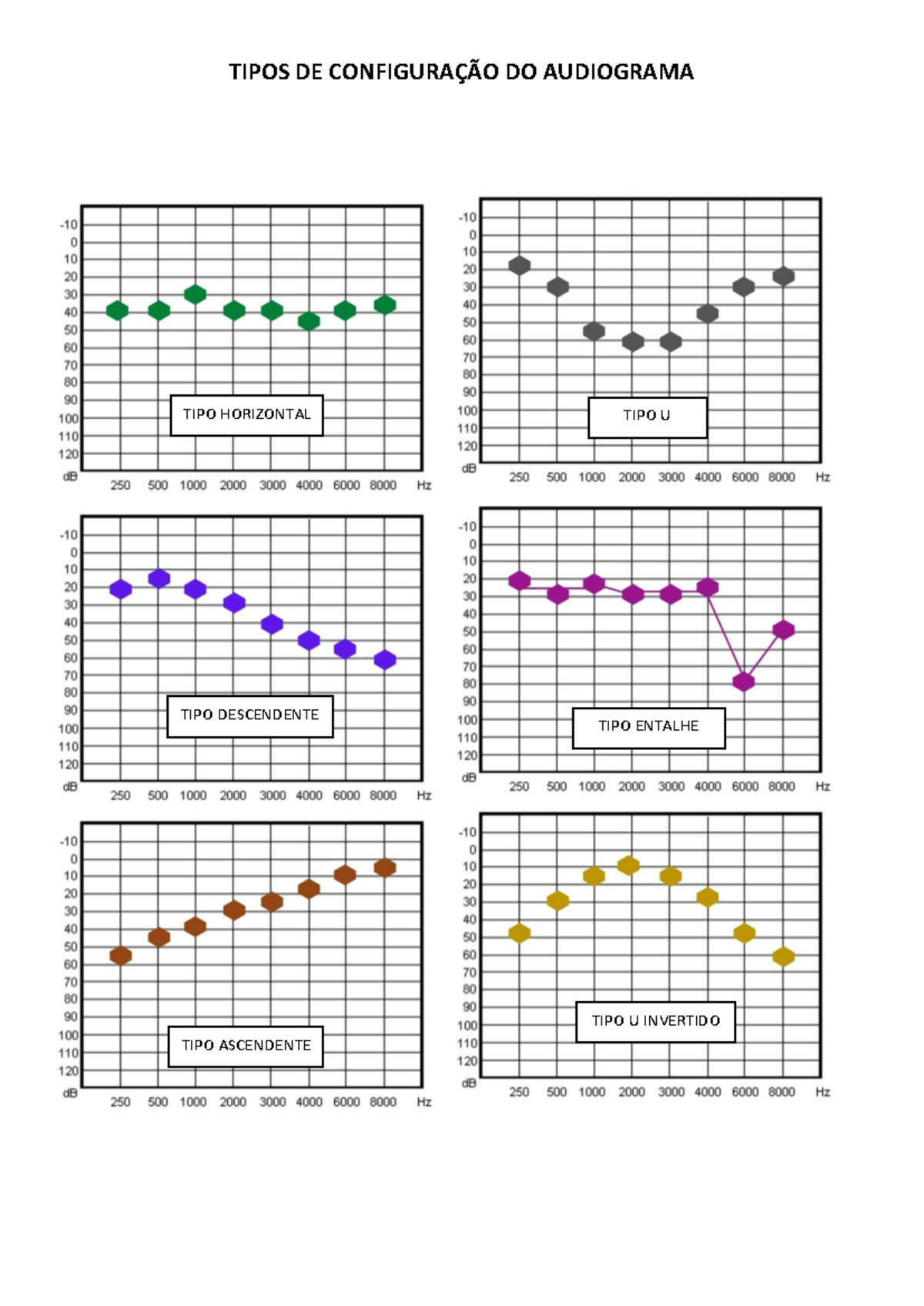 Tipos DE Configuração DO Audiograma - Diagrama de blocos - TIPOS DE ...